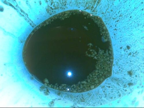 Douleurs + traces dans les selles : votre avis ? ver solitaire