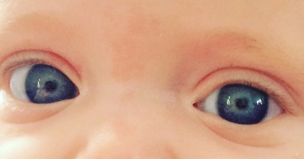 Les yeux de nos baby ! - Bébé grandit - FORUM Grossesse & bébé - Doctissimo