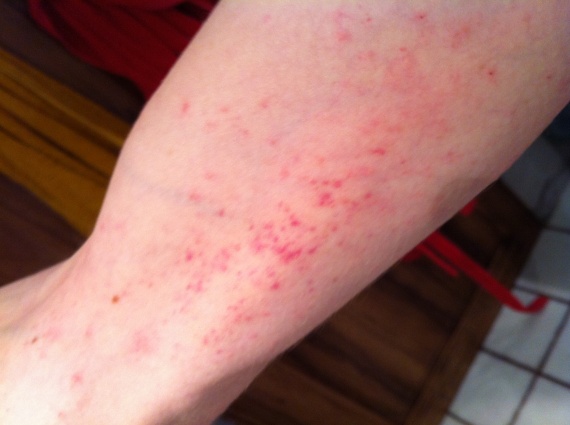 Gratage, plaque rouge, bouton...