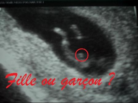 Déchiffrer une écho précoce pur savoir le sexe - Echographie ...