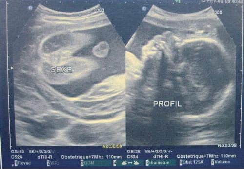 Notre écho morpho du 2ème trimestre !! c'est ici avec photos et détail