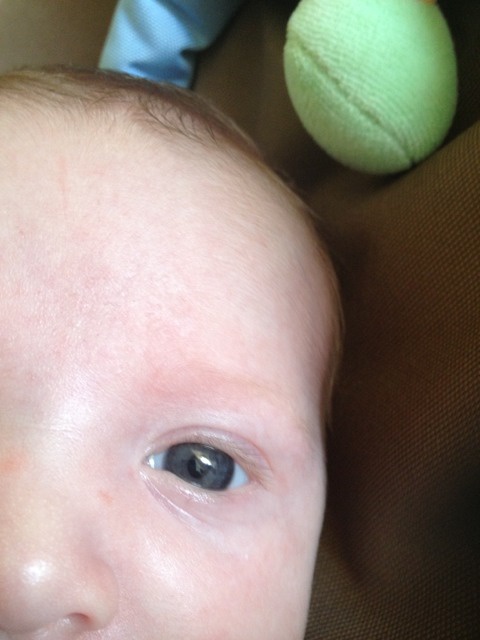 évolution de la couleur des yeux - Développement de l'enfant - FORUM ...