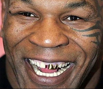 Le top 10 des stars les plus moches